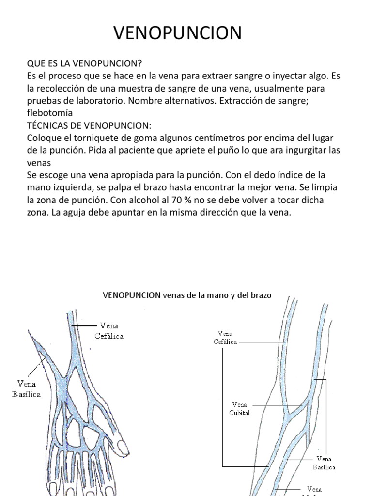 Técnicas y Venas para Venopunción | PDF