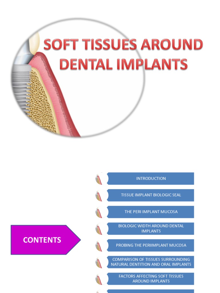 Soft Tissues Around Dental Implants | PDF | Dental Implant | Anatomy