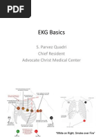 Abnormal ECG Findings in Athletes: Seattle Criteria | PDF ...