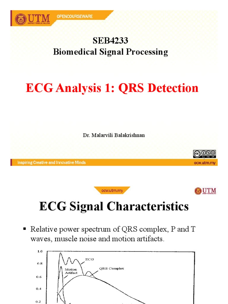 07 ECG Analysis 1 - QRS Detection - PPT (Compatibility Mode) | PDF | Filter (Signal Processing ...