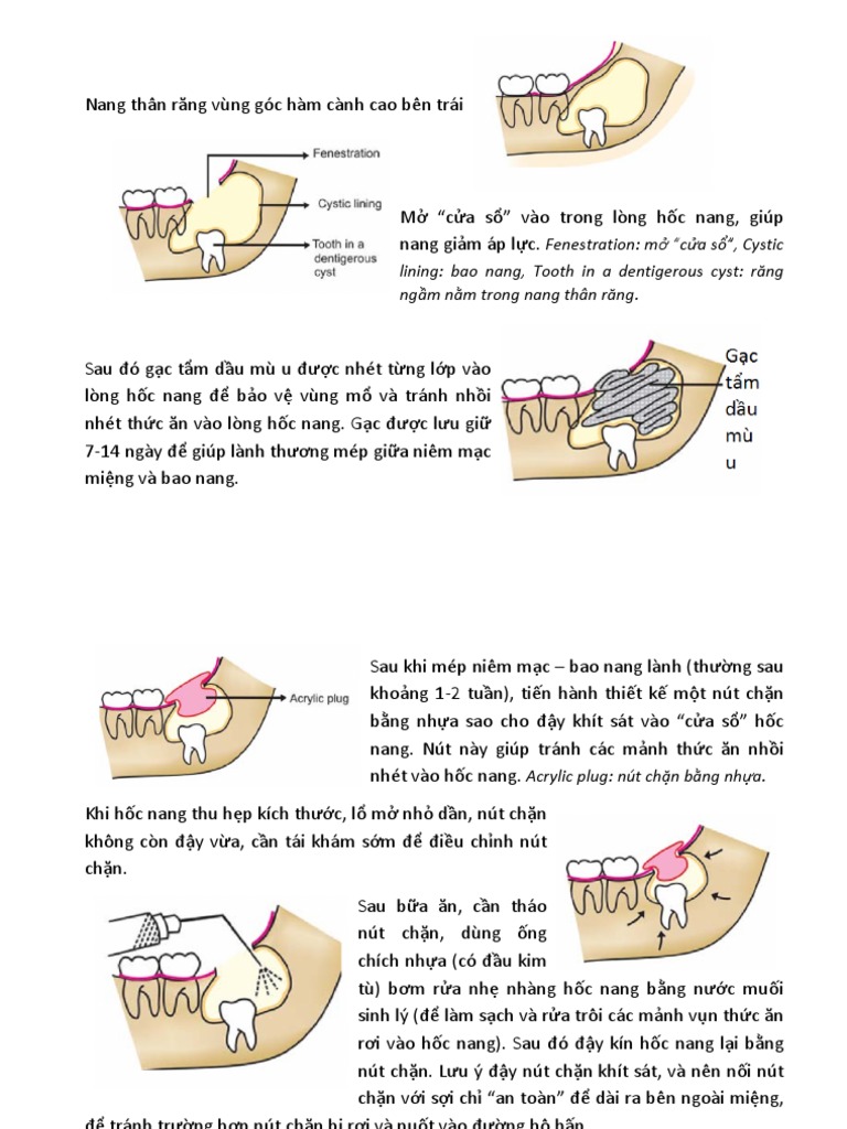 Procedure of Partsch 1 and 2 | PDF