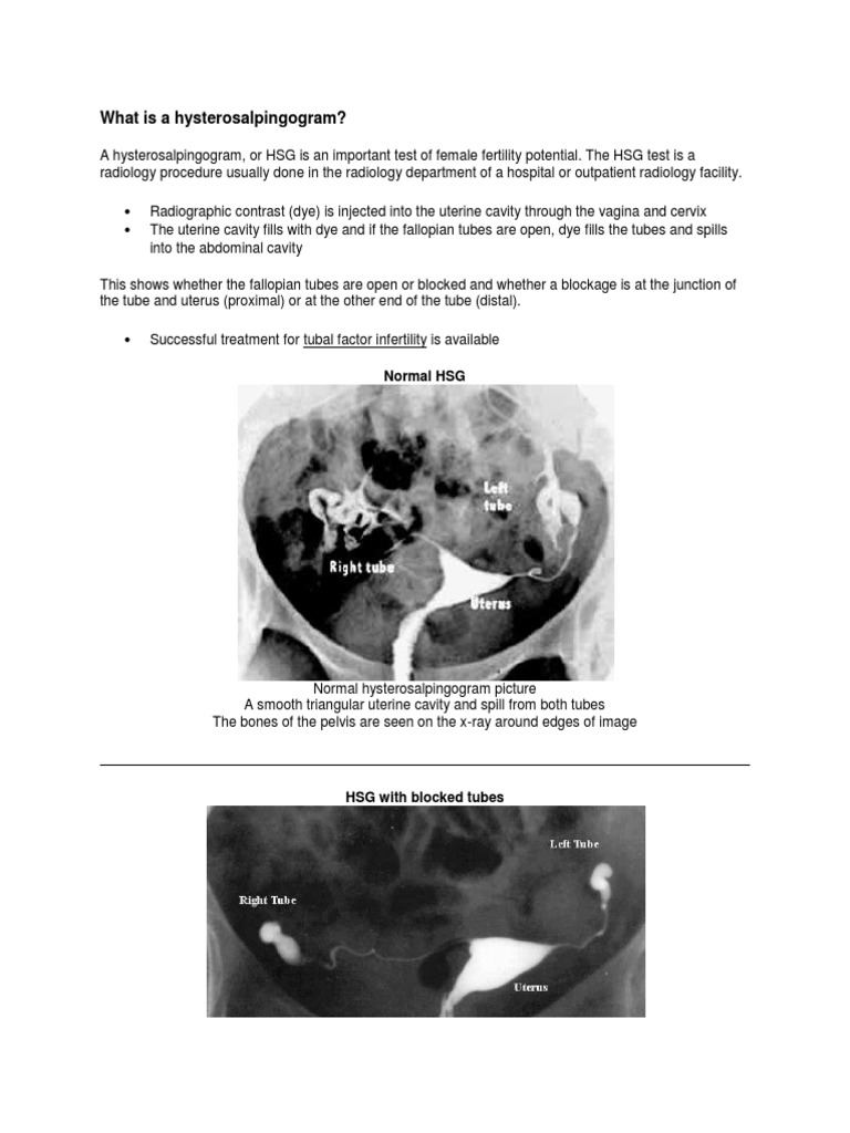 Hys Tero Salpingo Gram | PDF | Uterus | Sexual Anatomy