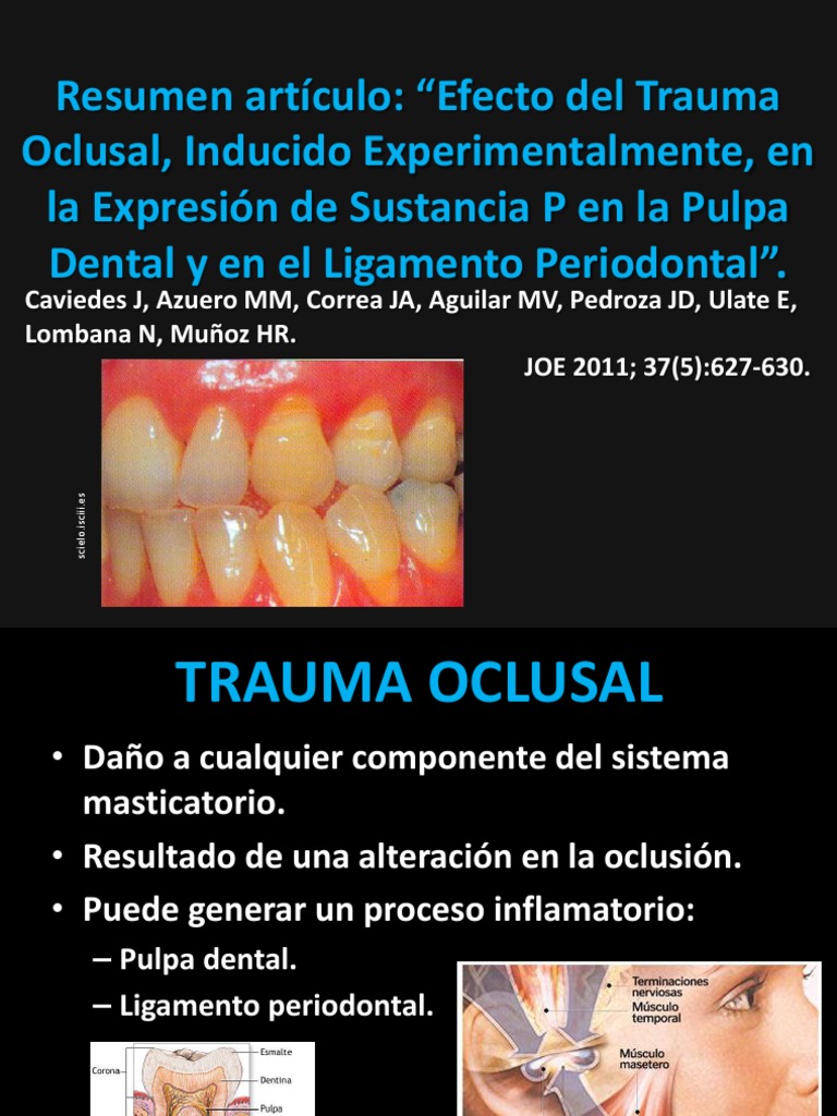 Efecto del Trauma Oclusal Inducido Experimentalmente.pptx | Inflamación ...