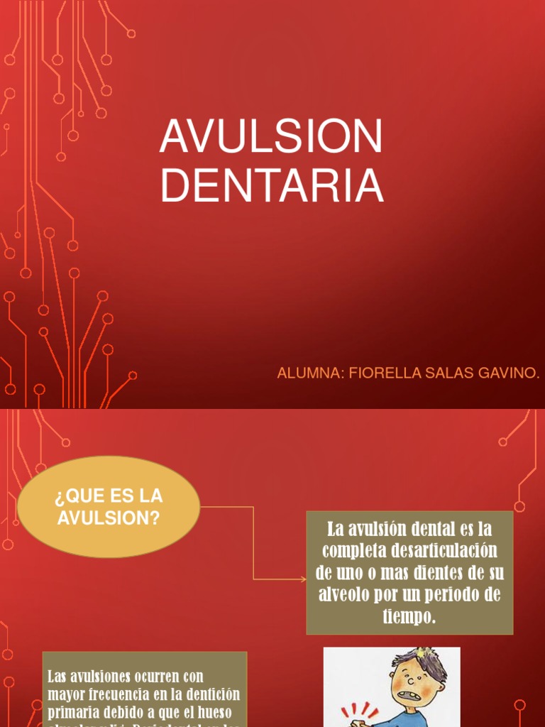 Avulsion Dentaria | PDF | Diente humano | Odontología