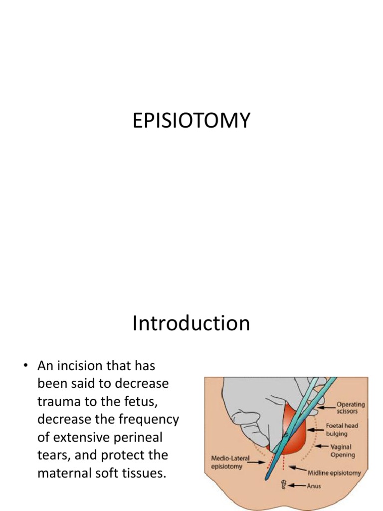 Episiotomy Teaching | Clinical Medicine | Medical Specialties