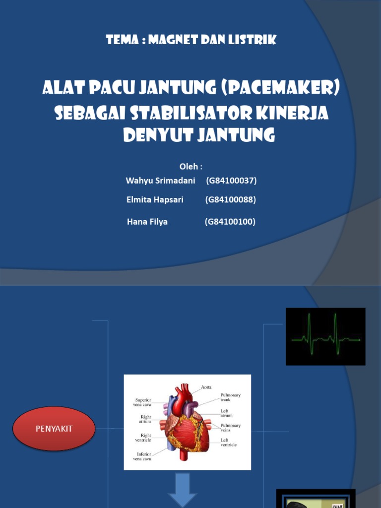 Fungsi dan Sejarah Alat Pacu Jantung | PDF