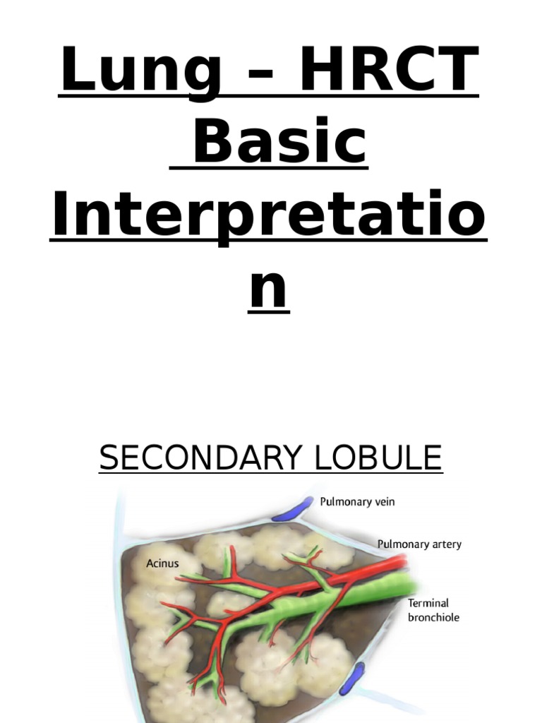 Lung - HRCT Basic Interpretatio N | PDF | Health Sciences | Diseases ...