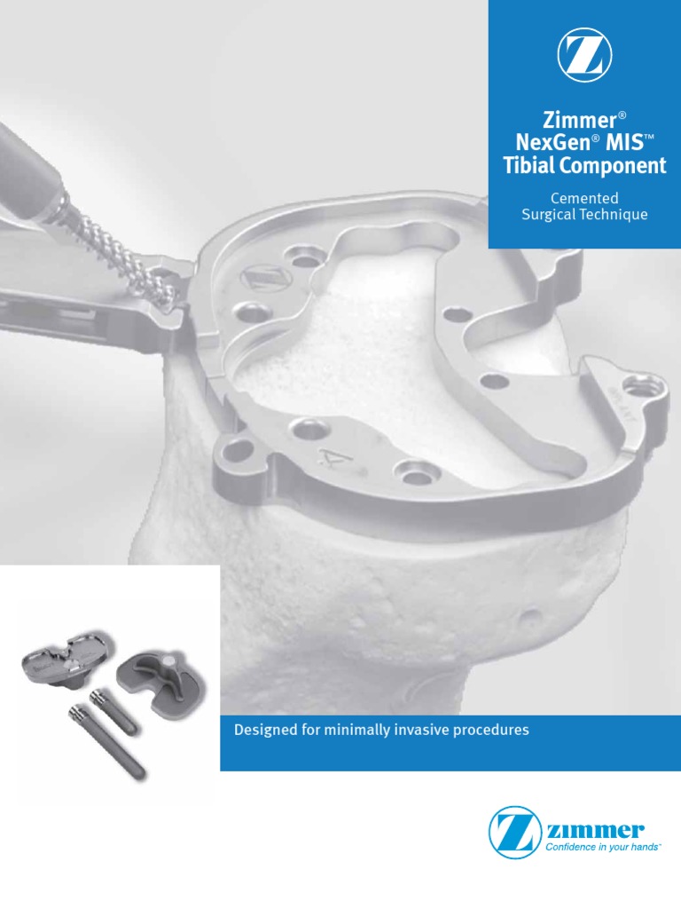 Image To Come: Zimmer Nexgen Mis Tibial Component | PDF | Orthopedic ...