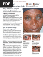 Sample Doctor Model Letter Conjunctivitis | PDF