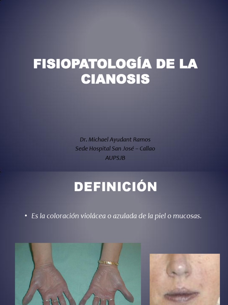 6-Fisiopatología de La Cianosis