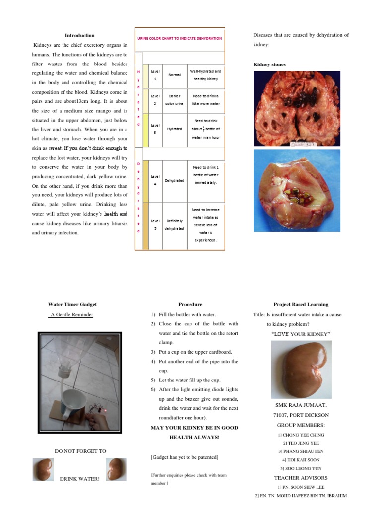 Urine Color Chart for Dehydration | PDF | Kidney | Urine
