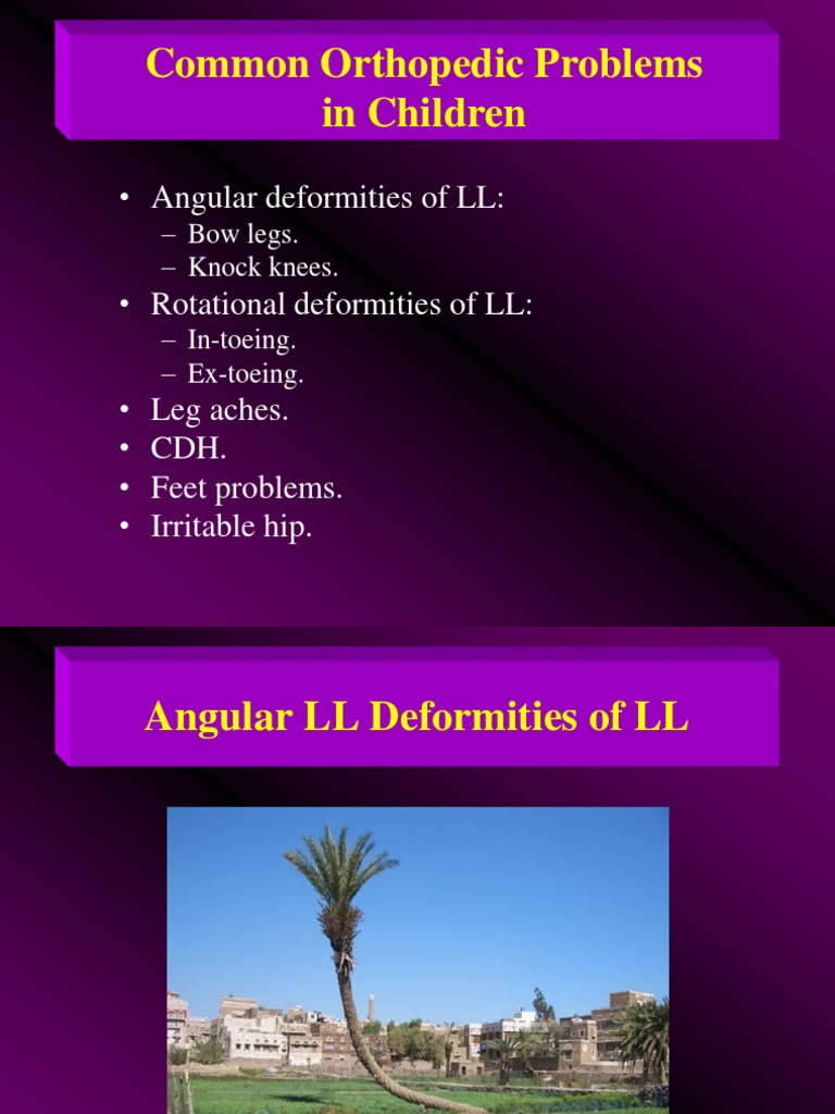 Common Orthopedic Problems in Children | PDF | Foot | Musculoskeletal ...