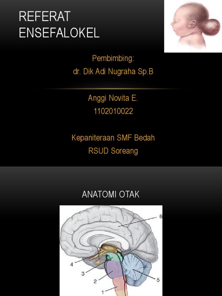 Pengertian dan Penanganan Ensefalokel | PDF