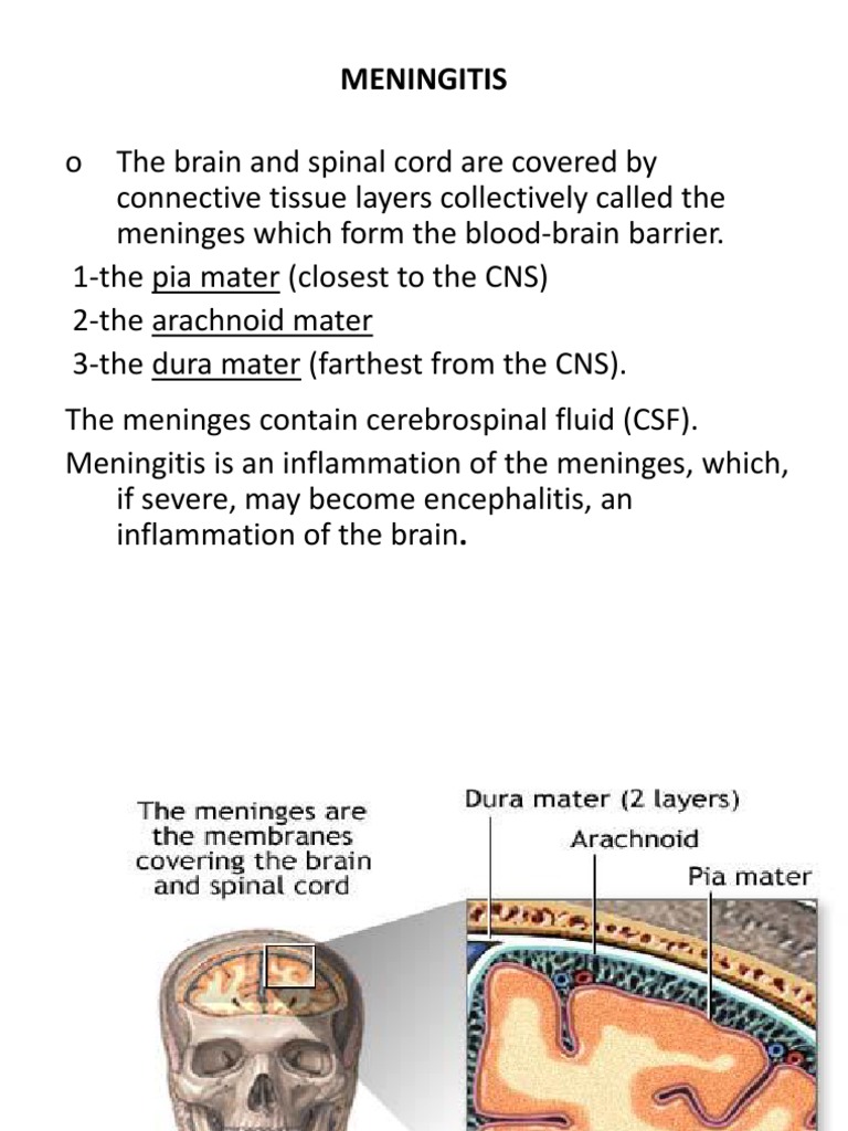 meningitis_(3).ppt | Meningitis | Infection