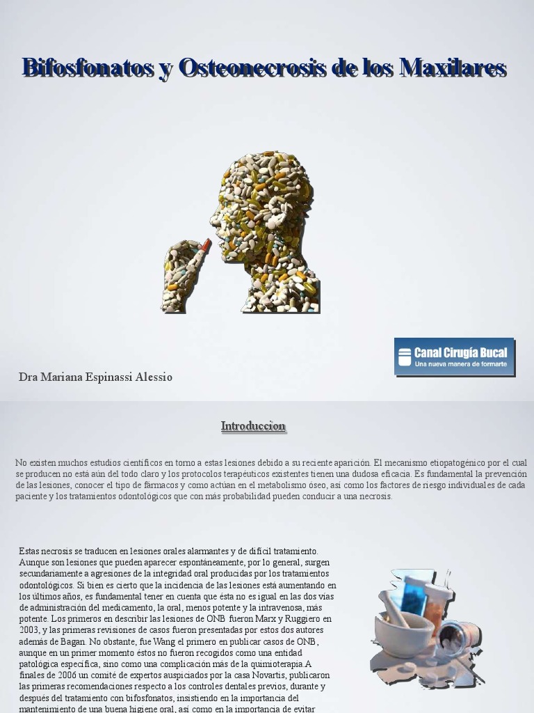 BIFOSFONATOS | PDF | Osteoporosis | Odontología