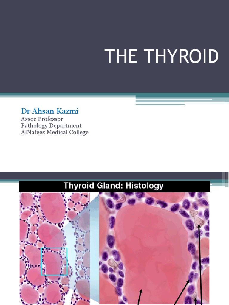 Thyroid Gland Pathology Overview | PDF | Thyroid | Hypothyroidism
