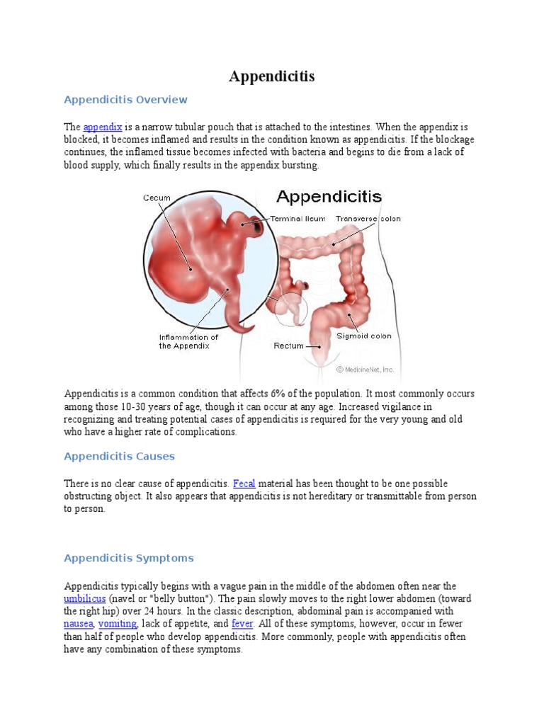 Appendicitis + Appendicectomy | Surgical Specialties | Surgery