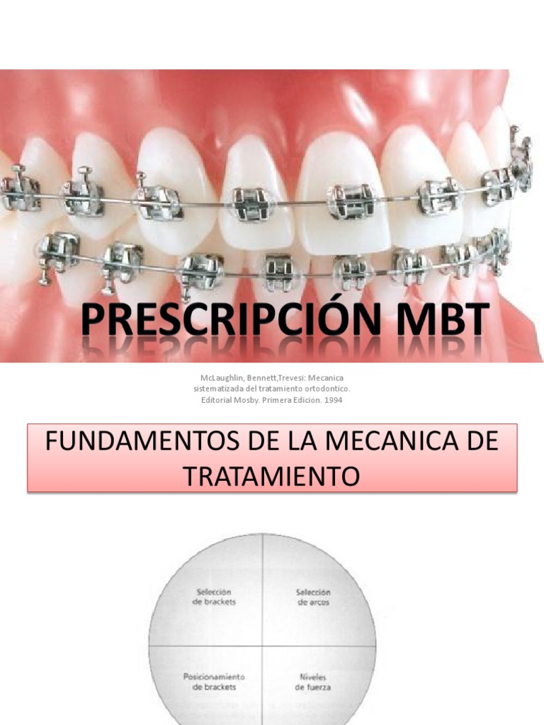 Prescripcion MBT
