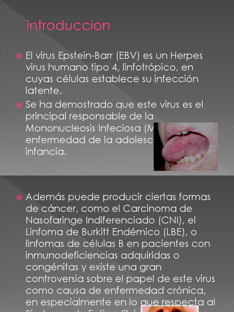 Epstein Barr | PDF | Virus | Microbiología