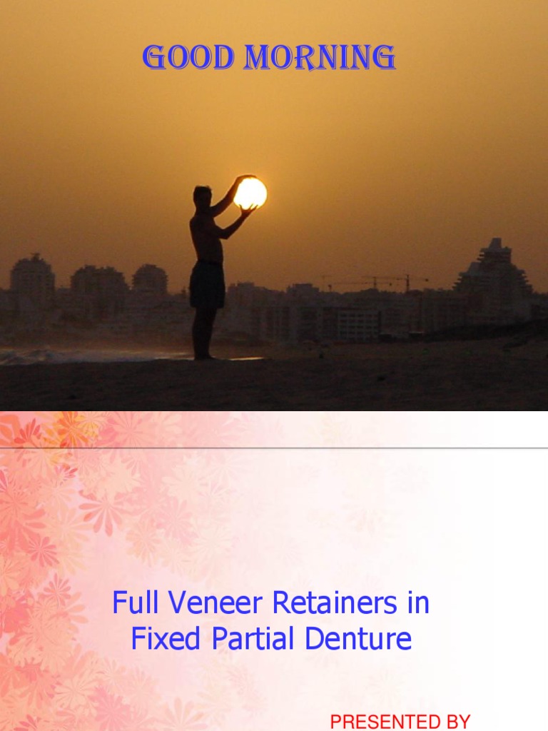 Full Veneer Retainers in FPD Explained | PDF | Dentistry | Mouth