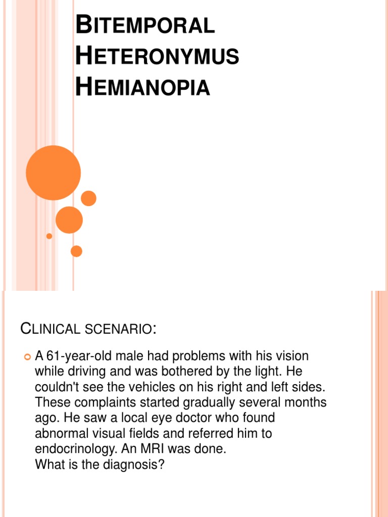 Bitemporal Hemianopia Overview and Treatment | PDF | Visual System ...