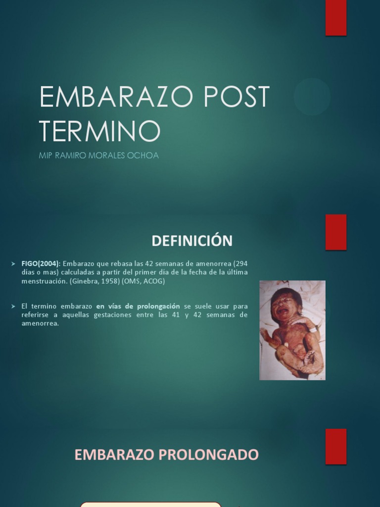 Embarazo Post Termino | PDF | El embarazo | Ciclo menstrual