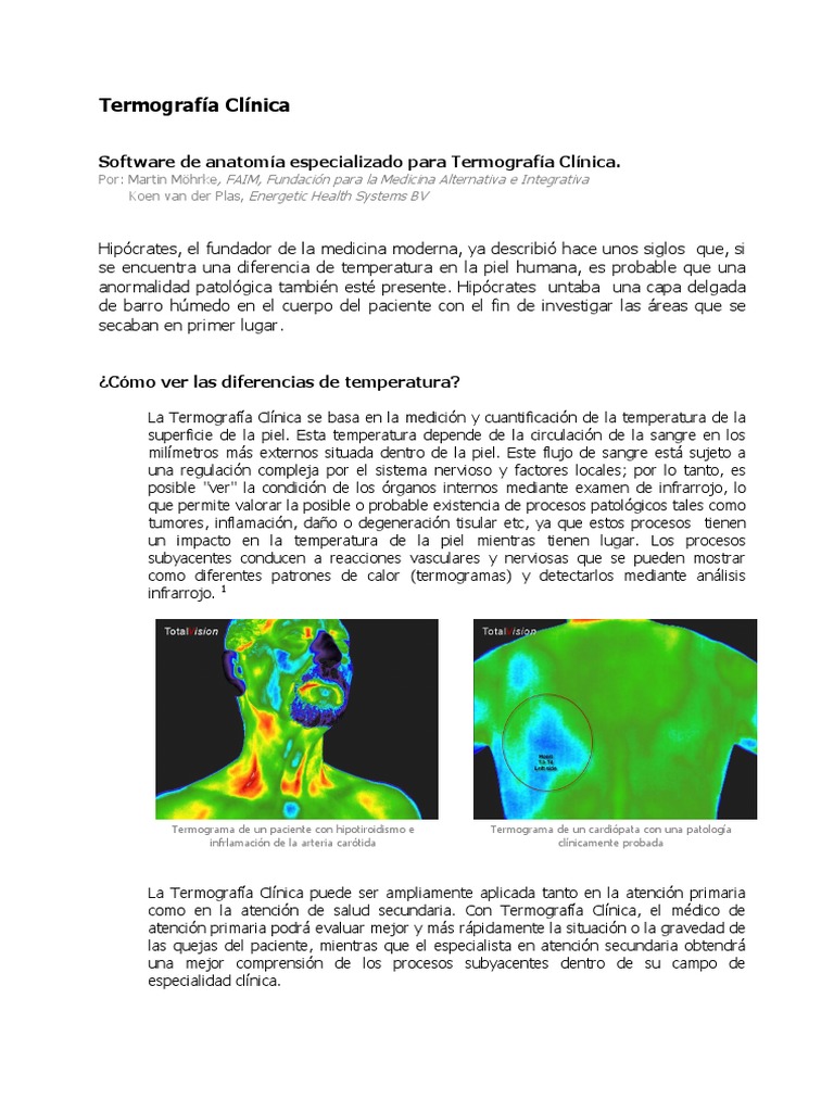 Termografía Clinica | PDF | Rayo X | Medicina