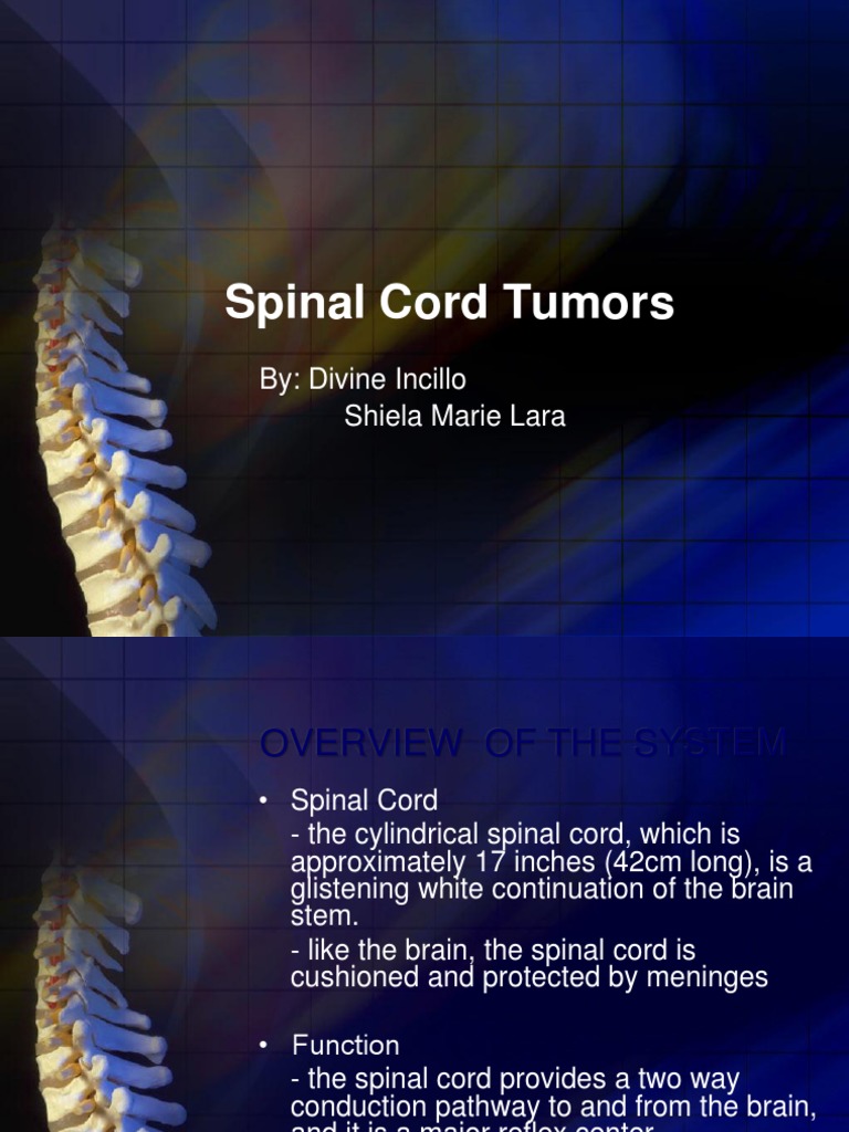 Spinal Cord Tumors | Vertebral Column | Radiation Therapy