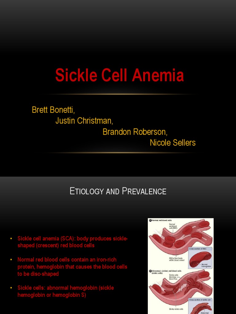 Sickle Cell Anemia Overview and Care | PDF | Sickle Cell Disease | Stroke