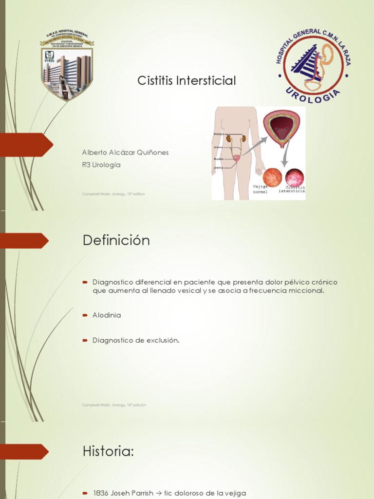 Cistitis Intersticial | PDF | Ciencia y matemáticas