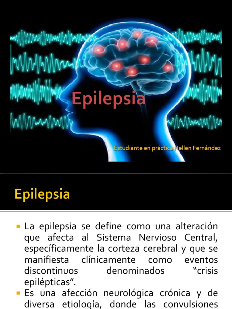Epilepsia | Epilepsia | Rtt | Prueba gratuita de 30 días | Scribd