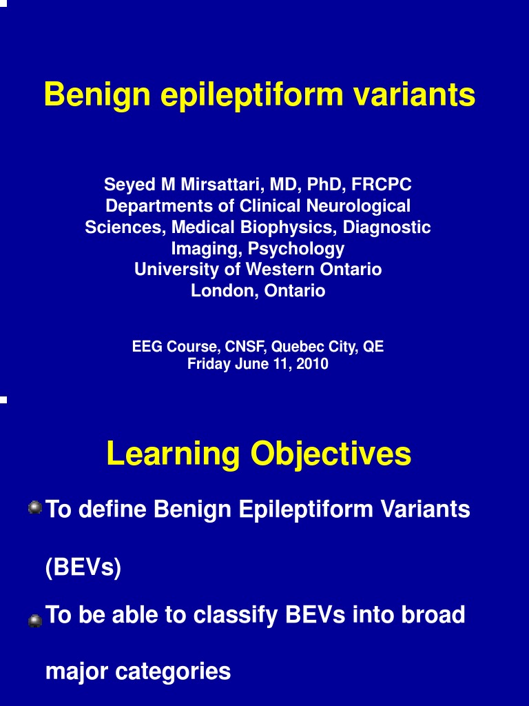 Benign epileptiform variants in EEG | Electroencephalography | Sleep