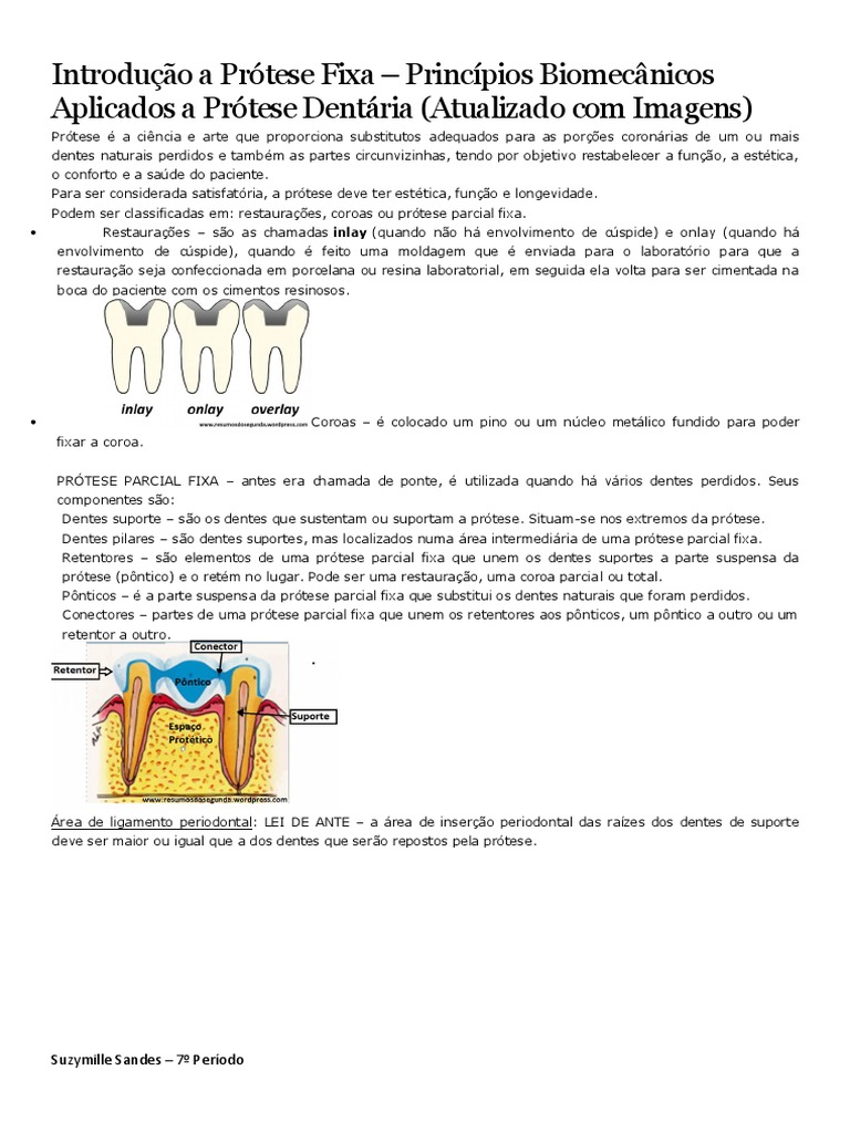 Princípios Biomecânicos da Prótese Fixa | PDF | Dente | Prótese