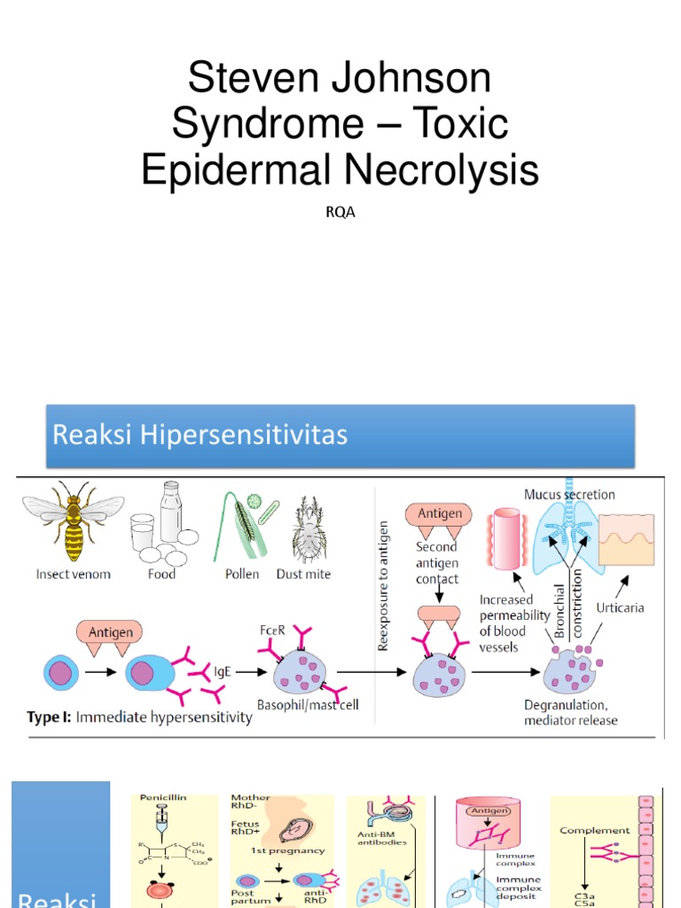 Steven Johnson Syndrome | PDF | Immunology | Immune System