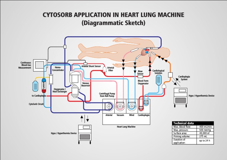 Cytosorb Application in Heart Lung Machine (Diagrammatic Sketch) | PDF