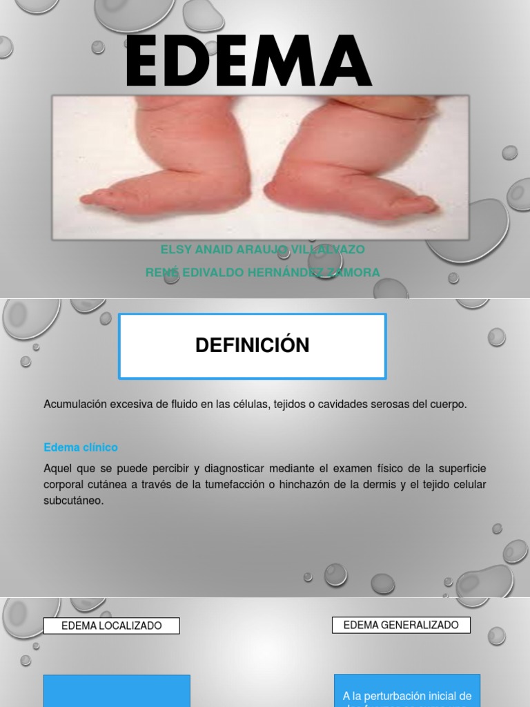 EDEMA-2 | Edema | Medicina CLINICA
