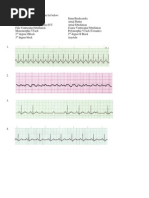 AHA ACLS Megacode Scenarios | PDF | Cardiopulmonary Resuscitation ...