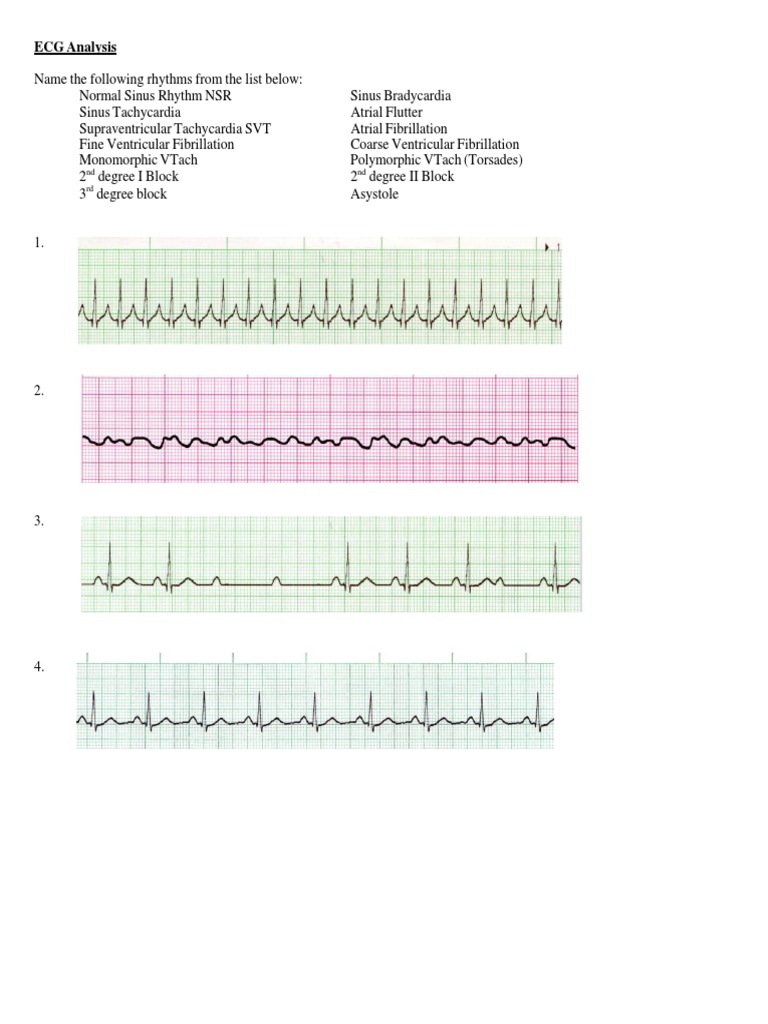 Acls | PDF | Cardiopulmonary Resuscitation | Cardiac Arrest