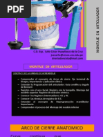 Protocolo Impresión Definitiva para Protesis Total | PDF | Dentadura ...