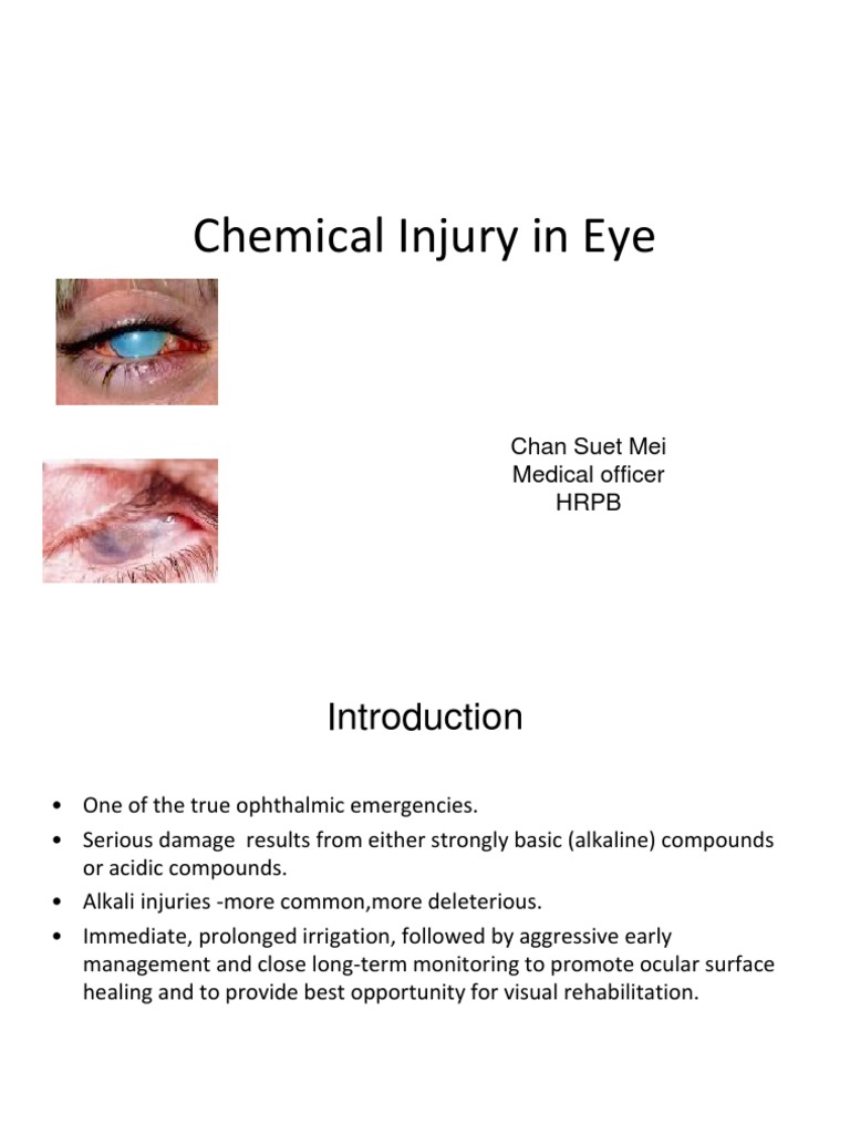 Chemical Injury in Eye | Cornea | Healing