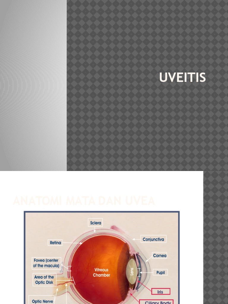 Uveitis | PDF