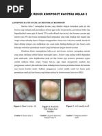Restorasi GIC (Sifat, Bahan, Indikasi, Aplikasi) | PDF
