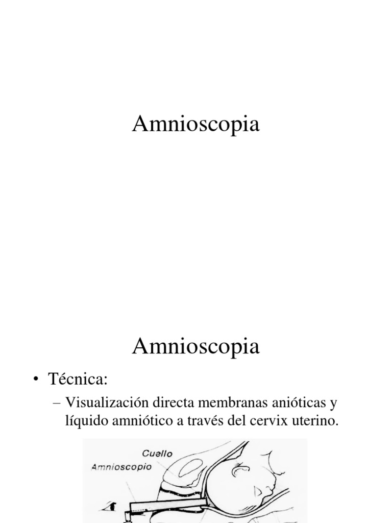 Amnioscopia: Indicaciones y Riesgos | PDF | Ciencia y matemáticas
