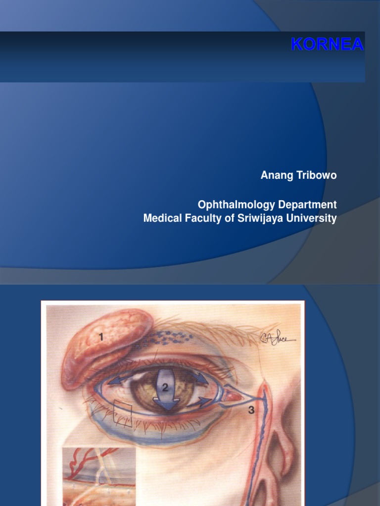 It 14 Ant Kornea Dan Keratitis Pdf Cornea Inflammation