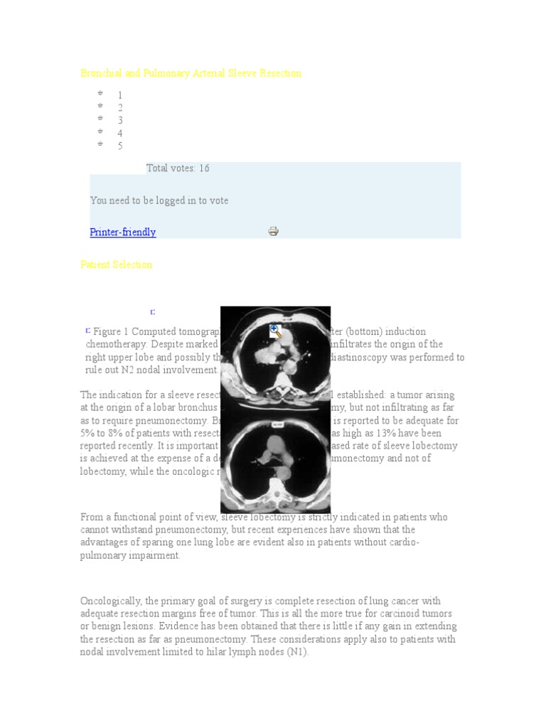 Bronchial Sleeve Resection Techniques | PDF | Medical Specialties ...