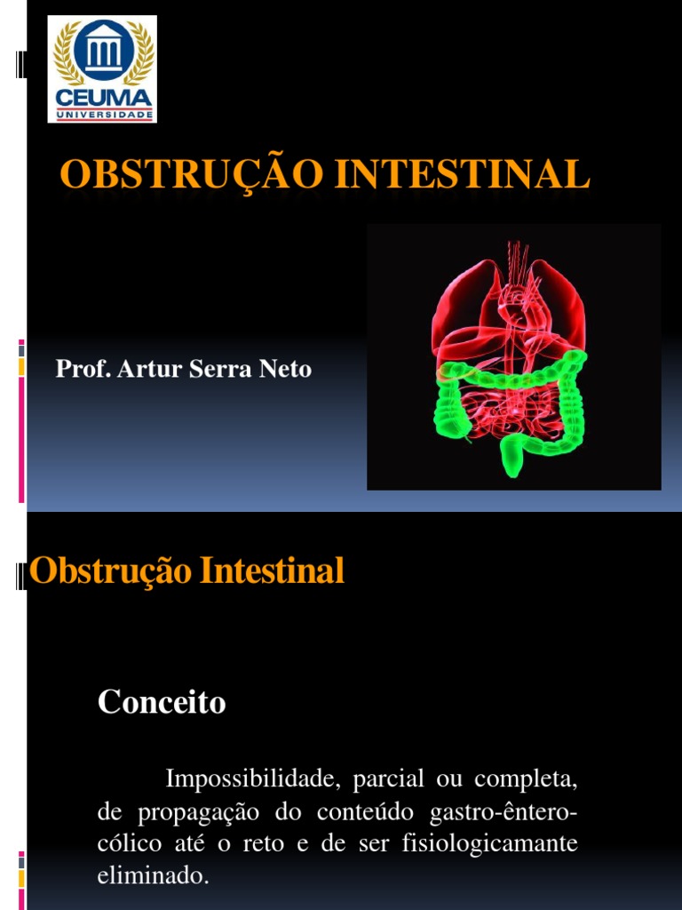 Causas e Tratamento da Obstrução Intestinal | PDF | Sepse ...
