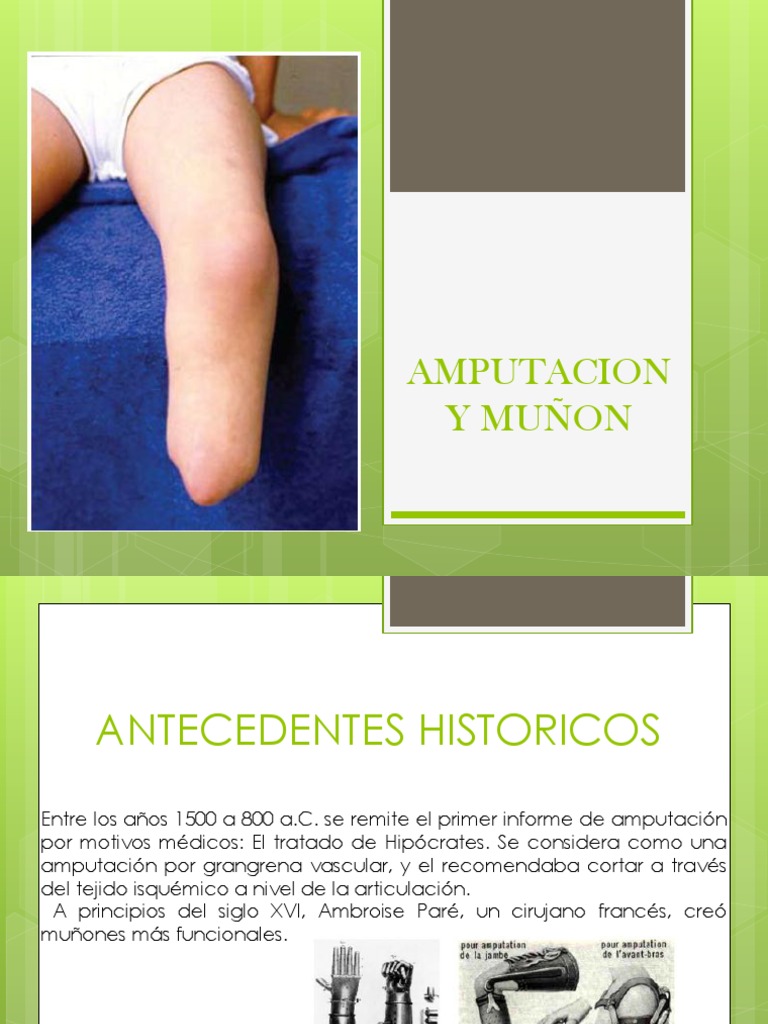 Amputacion y Muñon | PDF | Amputación | Rodilla
