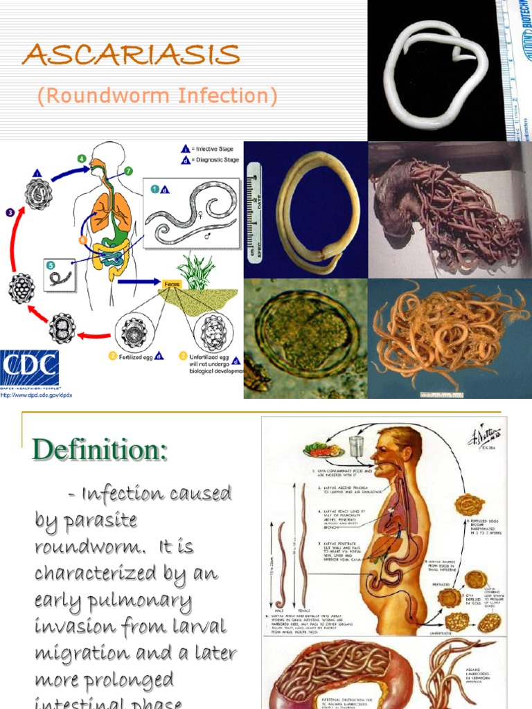 Ascariasis | PDF | Organ (Anatomy) | Health Sciences
