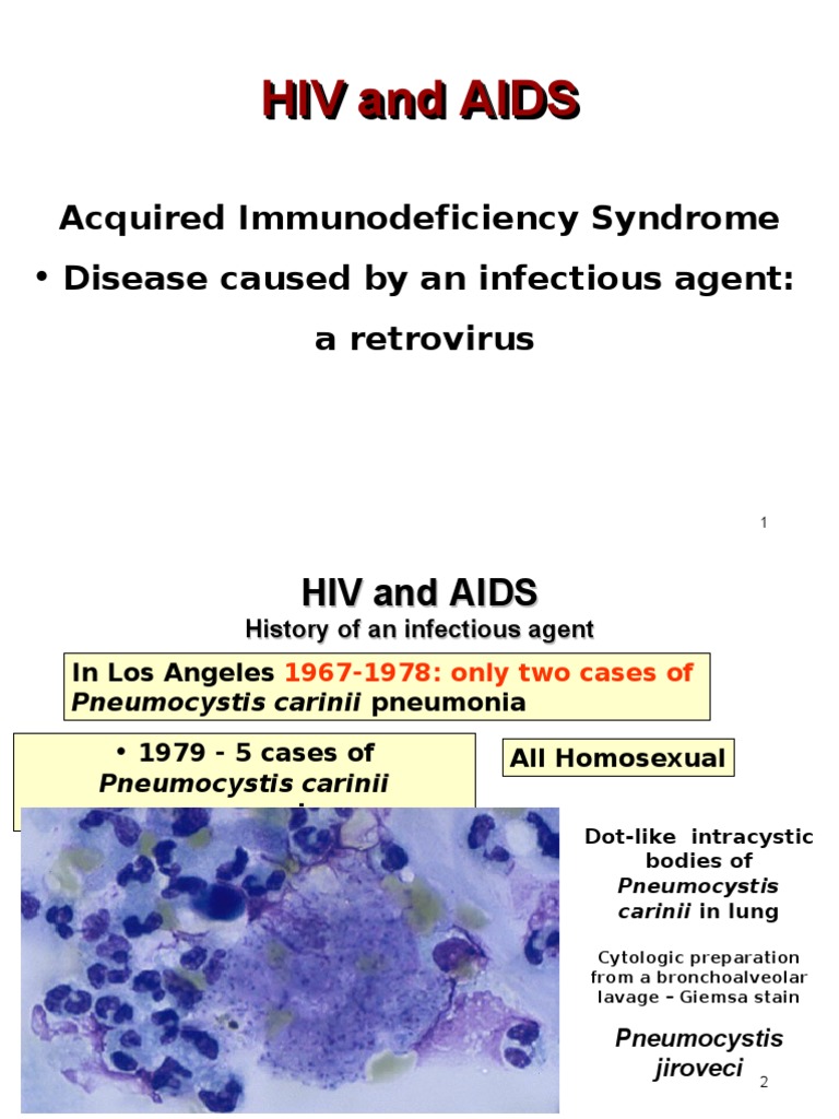 Understanding HIV and AIDS History | PDF | T Helper Cell | Hiv/Aids