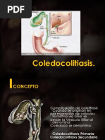 Protocolo Coledocolitiasis 1208258857789208 9 | PDF | Enfermedades ...